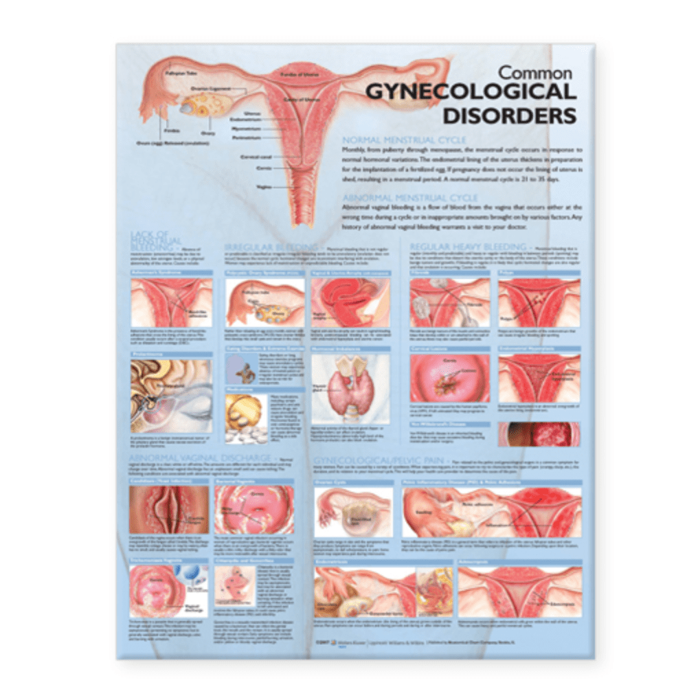 Education :: Anatomical Charts :: Common Gynecological Disorders ...
